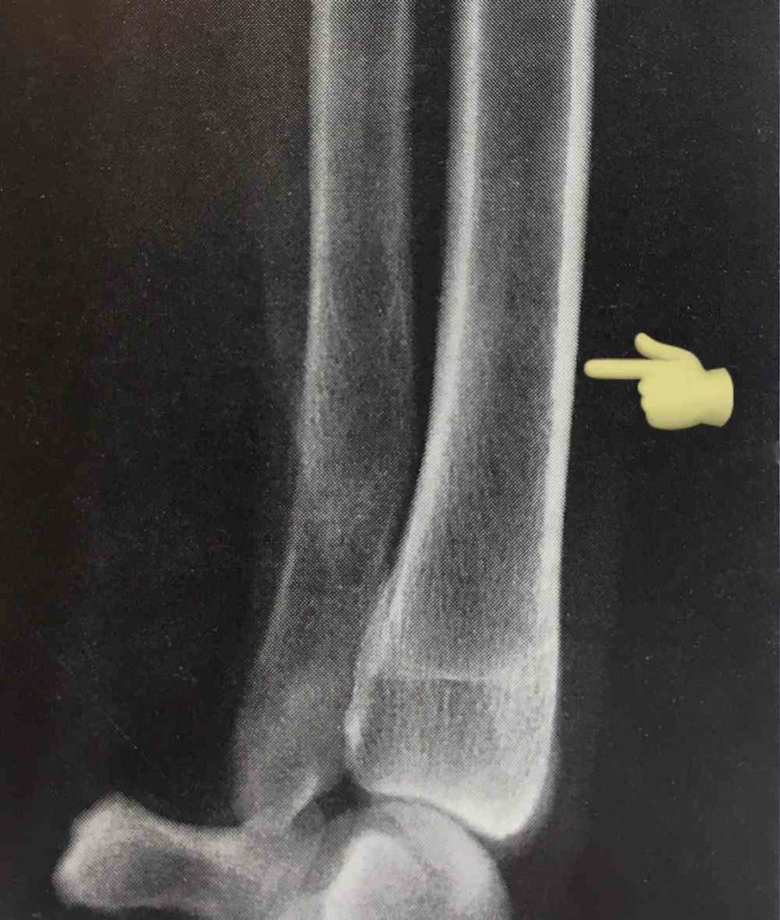 How Often Do Italian Greyhounds Break Legs? Walkerville Vet