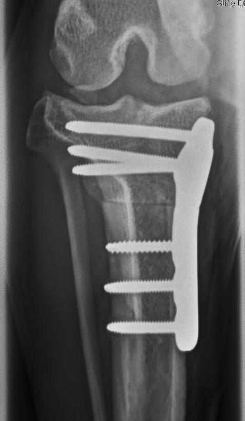 TPLO Cruciate Surgery For Adelaide Dogs | Walkerville Vet