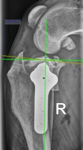 TPLO Cruciate Surgery For Adelaide Dogs | Walkerville Vet